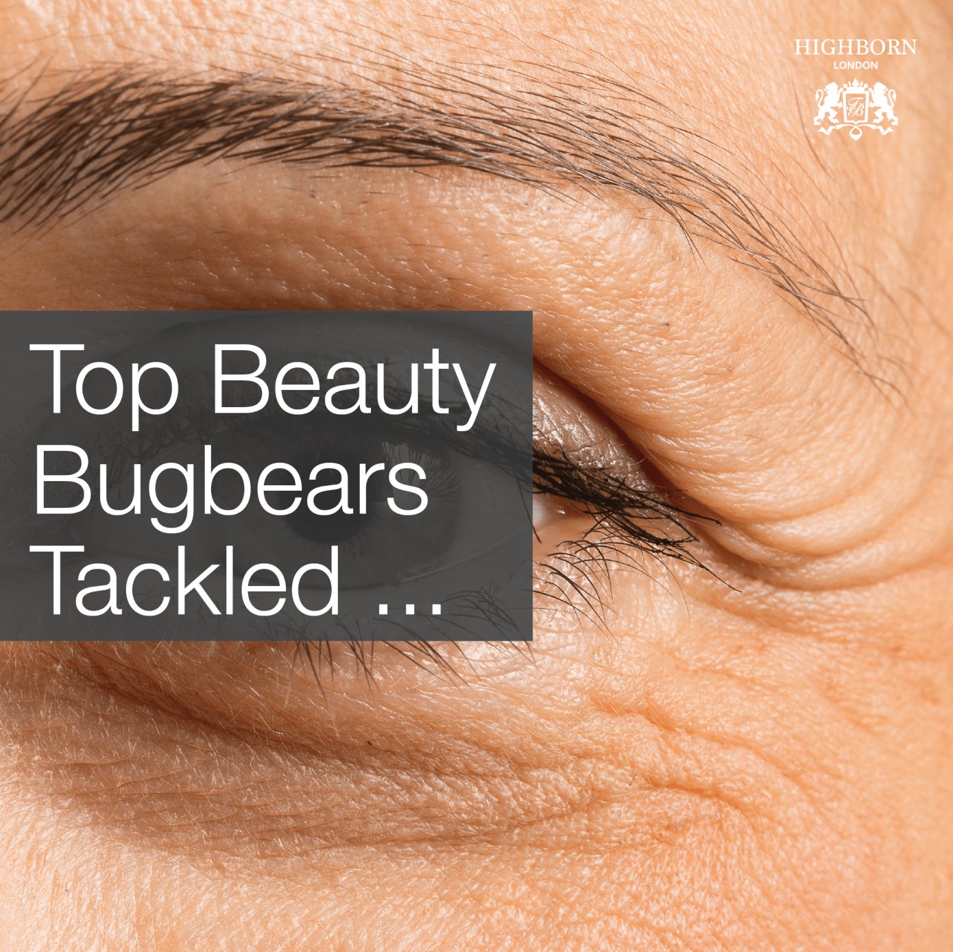 Quick Tips For Tackling The 5 Most Common Beauty Bugbears – Highborn London